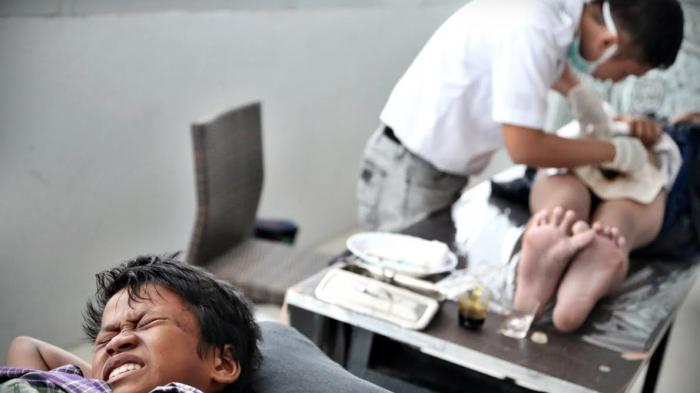 FOTO: HUT ke-6, Wisma Kalla Gelar Sunatan Massal - Tribun-timur.com