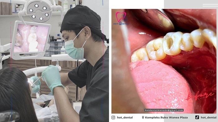 7 Cara Merawat Gigi agar Tetap Sehat, Kurangi Makanan Manis hingga ...