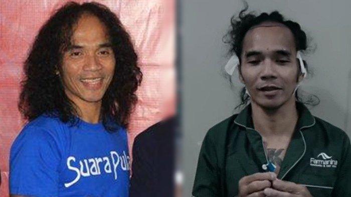 Akhirnya Terungkap Kabar Kaka Slank, Dulu Cuek Rawat Rambut, Kini ...