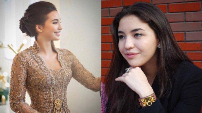 Ingat Manohara? Penampilannya Kini Bikin Pangling Masyarakat, Ini Kabar ...