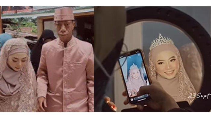 Masih Ingat Surya Manurung? Artis Tiktok Penderita Sindrom Langka Kini ...