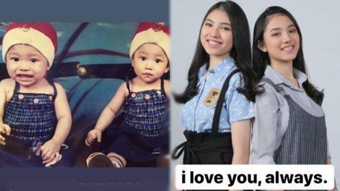 Melisha dan Melitha Sidabutar: Kembar yang Lahir hingga Meninggal Dunia ...