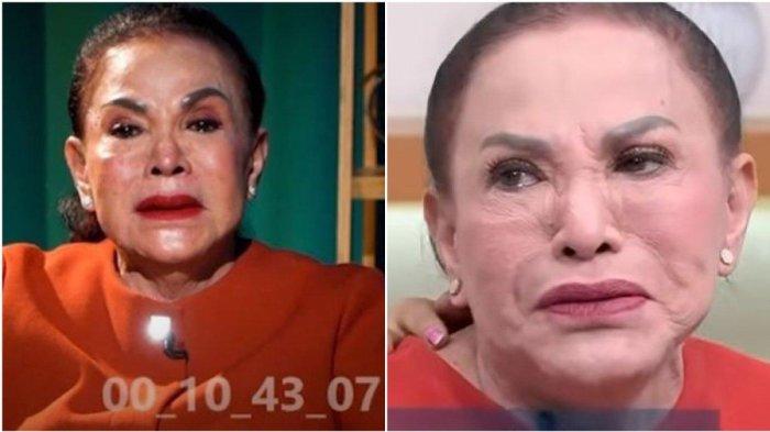 Akhirnya Terungkap Ternyata Mpok Atiek Hanya Bisa Konsumsi Makanan yang ...