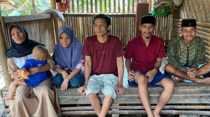 Viral Satu Keluarga Alami Kebutaan, Ini Gejala Awal Sampai Tak Bisa Melihat: Mata Perih dan ...