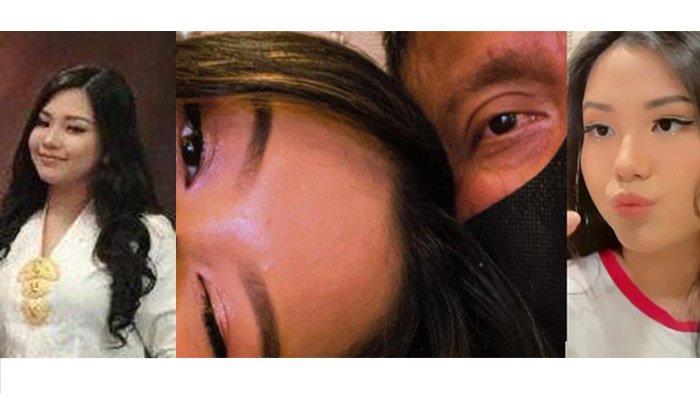 Potret Terbaru Trisha Eungelica dan Ferdy Sambo, Caption Foto Bersama Sang Ayah Tuai Sorotan ...