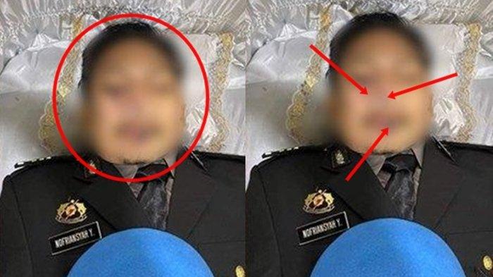 Luka Sayatan pada Jenazah Brigadir J Bukan karena Senjata Tajam ...