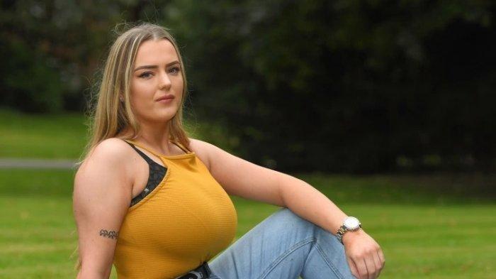 Mahasiswi Cantik Ini Sering Diejek karena Bentuk Tubuhnya hingga Buat ...