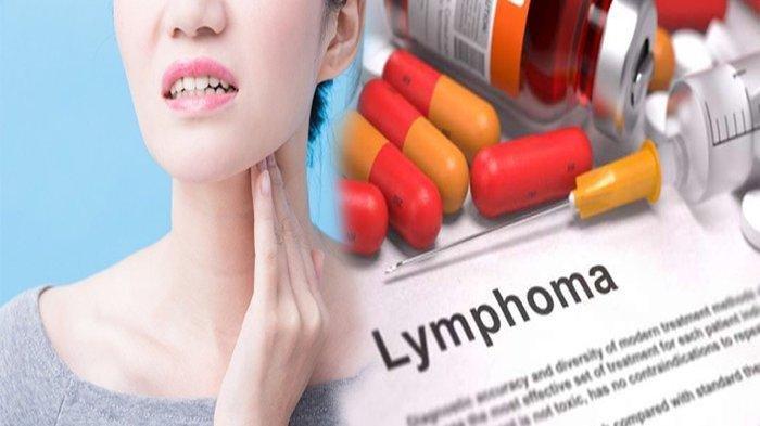 Apa Itu Limfoma Maligna? Kanker yang Muncul di Sel Sistem Kekebalan, Ini Gejala & Cara ...