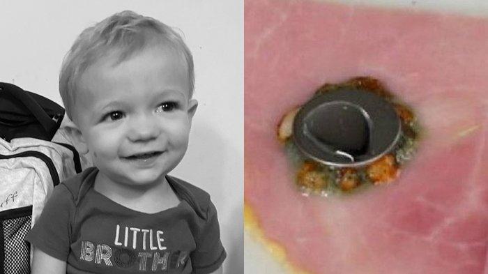 Selamat Jalan Johnathan, Bayi 2 Tahun Tewas Kehabisan Darah Usai Telan ...