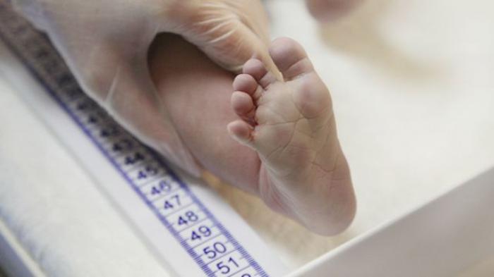 Lahir dengan 3 Organ Intim, Kasus Bayi Lahir dengan Kondisi Triphallia ...