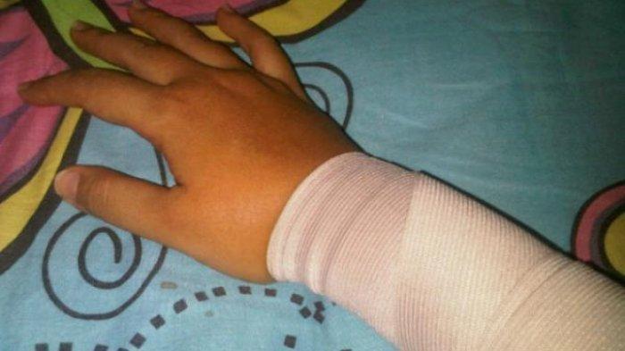 Kadisnaker Minsel: Korban Kecelakaan yang Tangannya Putus Berhak Dapat ...