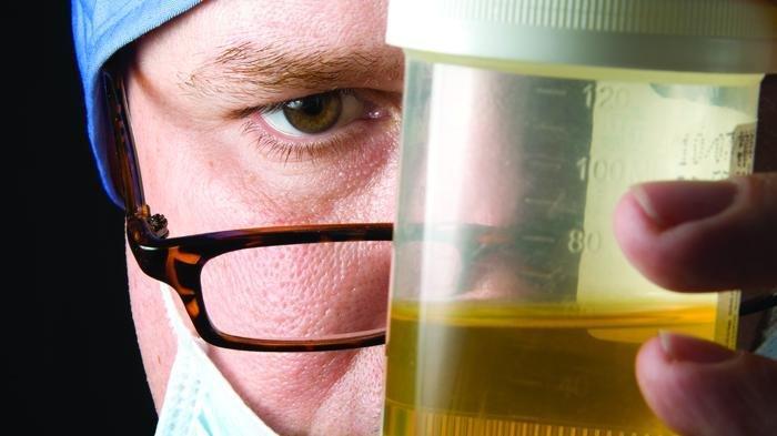 Urine Jadi Kuning Saat Puasa Bagus Atau Tidak? Ini Penjelasannya ...
