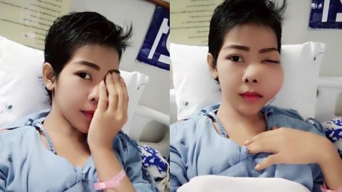Awalnya Disangka Sakit Gigi Biasa, Rahang Gadis Ini Terus Membengkak ...
