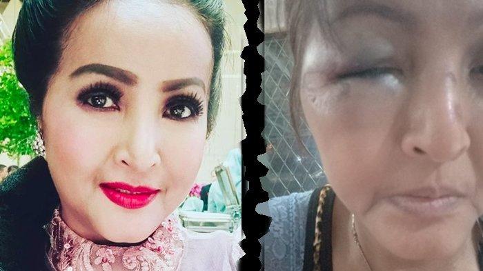 Siapa Machica Mochtar? Penyanyi yang Jadi Korban Tabrak Lari, Pernah ...