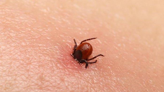 Balita Tewas Digigit, Benarkah Kutu Kucing Bisa Sebabkan Kematian? Ini ...