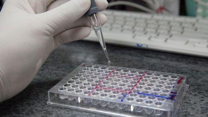 HARUS TAHU, Apa Itu Rapid Test, PCR dan Swab Tenggorokan hingga Istilah ...