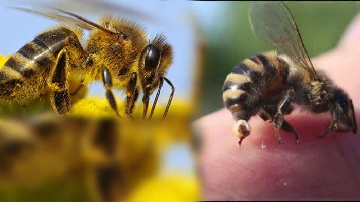 Jangan Sembarangan, Begini Cara Tangani Ketika Terkena Gigitan Lebah ...