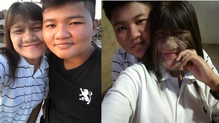 Heboh! Dinobatkan Jadi 'Gadis Paling Berbulu di Dunia' Karena Rambut ...