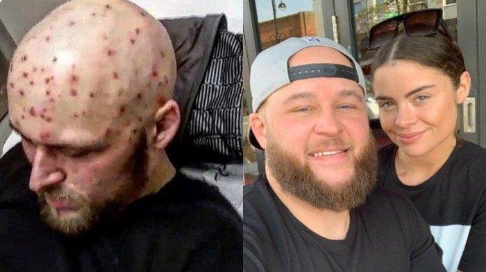 Kisah Hunter Shepard, Pecandu Heroin, Sembuh Usai Bertahun-Tahun ...