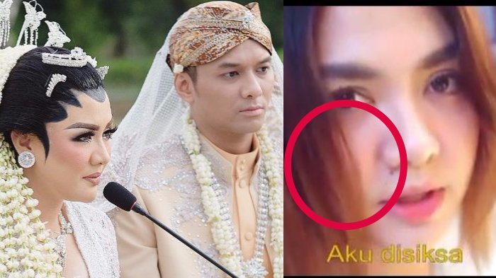 Alamaaak! Baru Menikah, Dapat Perlakuan Begini dari Sang Suami, Vicky ...