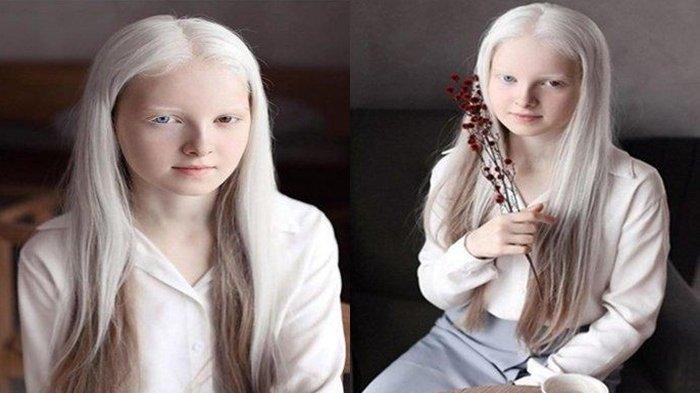 Sosok Gadis Cantik Bermata Biru & Cokelat, Kulit, Rambut hingga Bulu ...