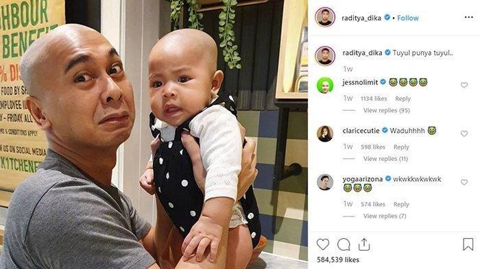 Potret Kompak Raditya Dika dan Anaknya, Sama-sama Botak: Ibu Kandungnya ...