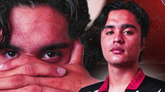 Bursa Transfer Liga 1: Arema FC Kontrak Brandon Scheunemann Selama 2 ...