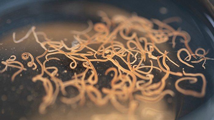 Viral Perut Anak 3 Tahun di Jember Membesar dan Dipenuhi Cacing, ini ...