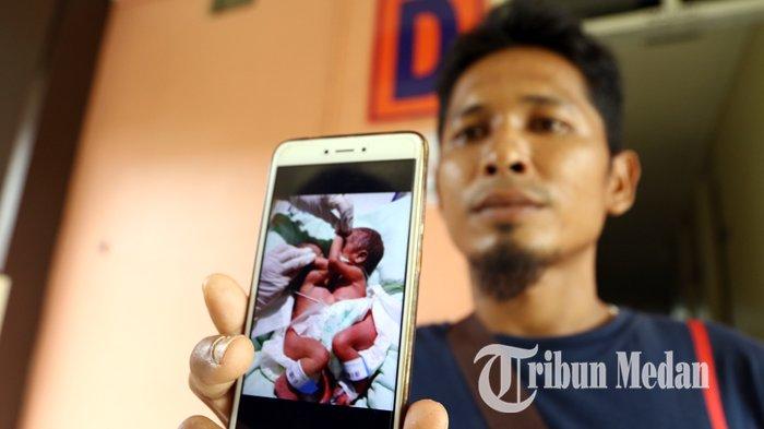 Sempat Drop, Kondisi Bayi Kembar Siam Asal Labuhanbatu Terus Membaik - Tribun-medan.com