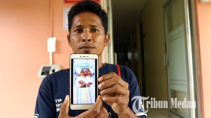 (VIDEO) Tim Dokter RSUP Adam Malik Siap Operasi Bayi Kembar Siam Asal Labuhanbatu - Tribun-medan.com