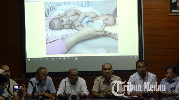 Berita Foto: Tim Dokter Tetapkan Operasi Pemisahan Bayi kembar siam Adam dan Malik - Tribun ...