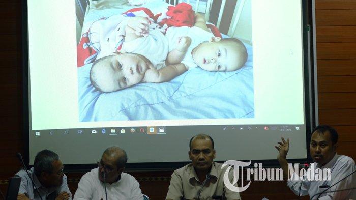 Operasi Pemisahan Bayi Kembar Siam Adam dan Malik Mengeluarkan Biaya Rp 600 hingga 700 Juta ...