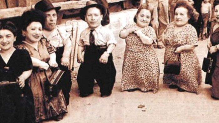 Nasib Keluarga Yahudi Cebol, Jadi Bahan Eksperiman Dokter Psikopat ...