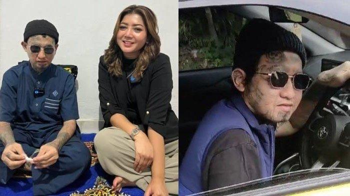 BEDA dengan Agus Salim, Icang Tak Rakus Donasi Meski Alami Kebutaan ...