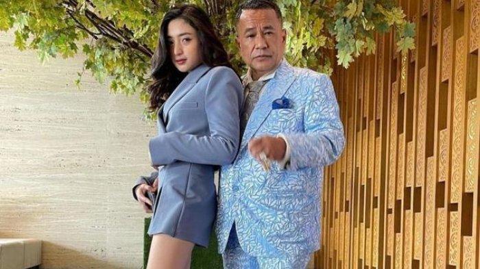 Aspri Hotman Paris Digebuki dan Diludahi Waria di Kelab Malam, Badannya Penuh Luka dan Lebam ...