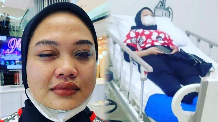 VIRAL Driver Ojol Tonjok Pegawai Ramen hingga Alami Memar di Mata - Tribun-medan.com