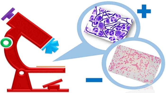 Apa Itu Pewarnaan Gram?, Materi Belajar Biologi Kelas 10 - Tribun-medan.com