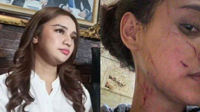 Regi Nazlah Bantah Tuduhan, Sebut Afifah Riyad yang Pukul Duluan, Ungkap Kronologi dan Bawa ...