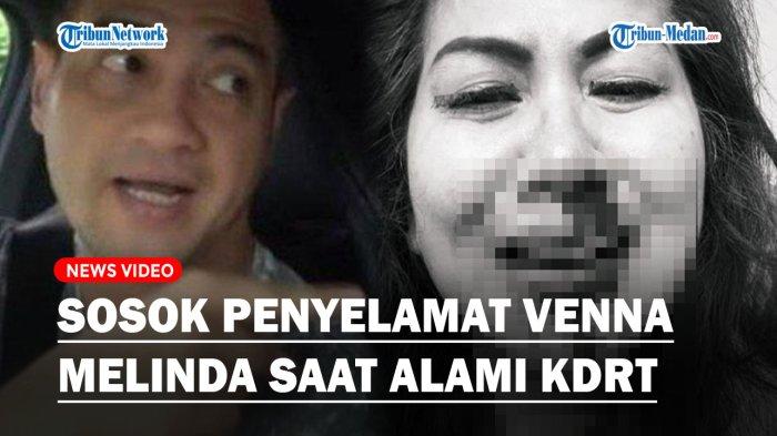 Sosok Penyelamat Venna Melinda saat Alami KDRT di Hotel dengan Kondisi Hidung Bersimbah Darah ...