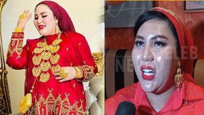 Produk Skincare Mira Hayati, Fenny Frans, dan RG Mengandung Bahan ...