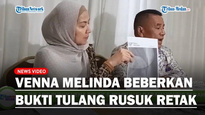 Venna Melinda Beberkan Bukti Tulang Rusuk Retak dan Pembuluh Darah Hidung Pecah Akibat KDRT ...