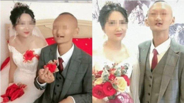 Menikah Dengan Pria Ompong, Wanita ini Dicap Hanya Incar Hartanya, Fakta Sebenarnya Menyentuh ...