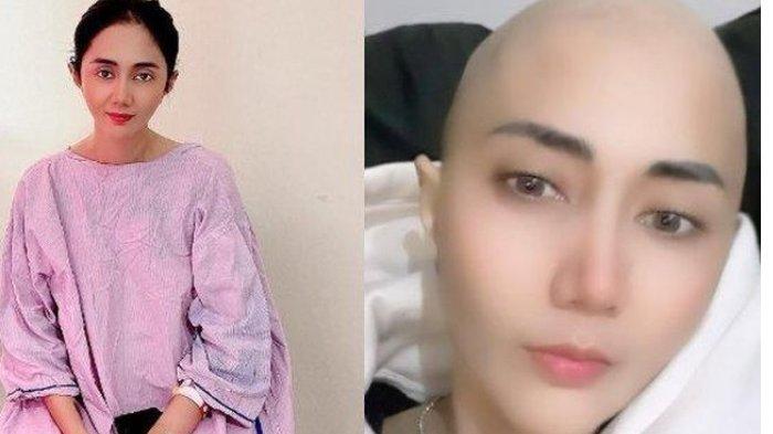 Rambutnya Sudah Botak, Artis Kena Kanker Payudara Ini Tetap Jadi DJ ...