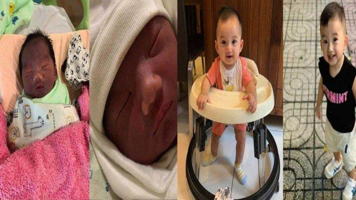 Lahir dengan Kulit Gelap, Bayi Ini Berubah Drastis jadi Putih dan ...