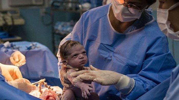 Bayi ini Terlahir Dengan Ekspresi Wajah 'Marah', Terus Cemberut Meski ...