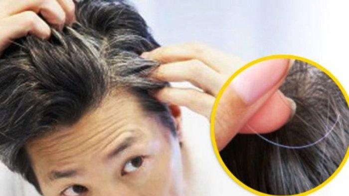 BERITA KESEHATAN: 4 Cara Mengatasi Uban di Usia Muda, Selain Perbanyak Asupan vitamin dan ...