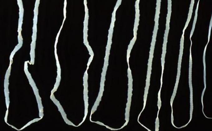 Cacing Raksasa dan Langka Ditemukan Ilmuwan di Perairan Filipina ...