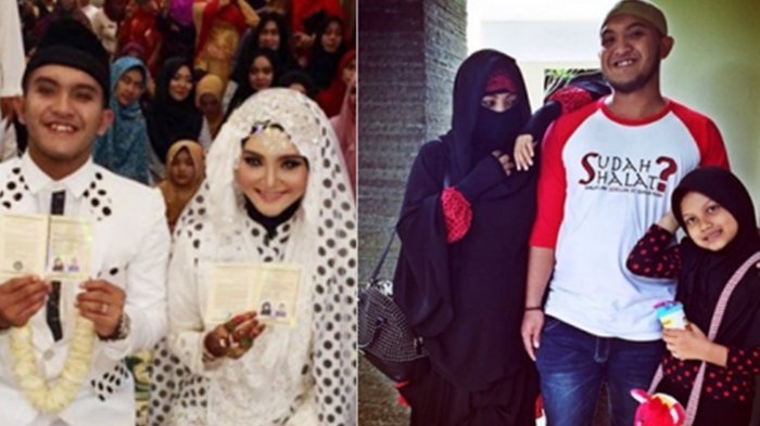 Mengidap Penyakit Kulit Langka, Istri Caesar YKS Minta Dipoligami ...