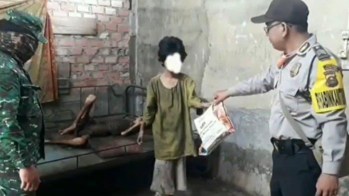 Bikin Mengiris Hati, 2 Warga Tinggal Tulang Berbalut Kulit Minta Makan ...