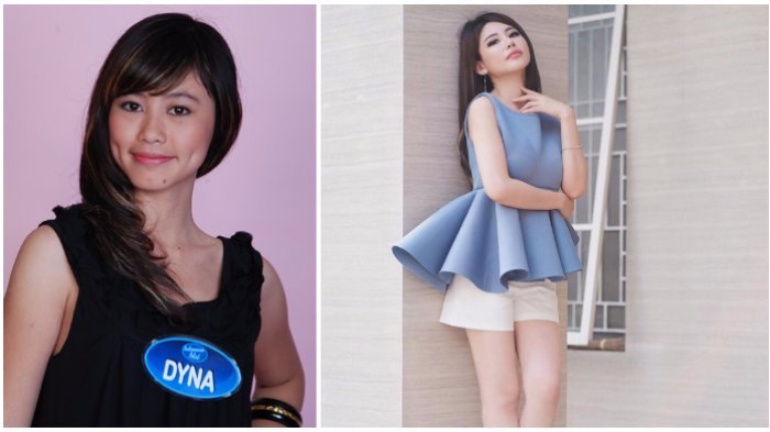 Terlahir Cantik, Tak Disangka Wajah Artis Ini Sudah Tidak Asli Lagi ...